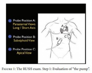 Evaluate “the tank”: