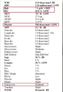 In his discussion, Dr. Mellick states that the treatment of Hemolytic ...
