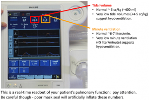 Look at the monitor and the patient, talk to the patient, perhaps try ...