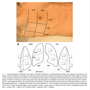 And here is an excellent YouTube video, Ultrasound Lung Scanning ...