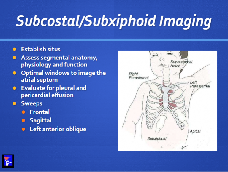 Abdominal Situs-Coronal View: 18