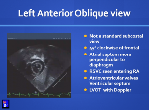 Subcostal Sagital: 25-27