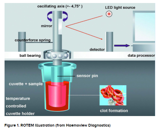 Both ROTEM and TEG provide a great deal of quantitative data; however ...