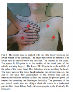 The phrenic point is lateral, defined in Fig. 2. The PLAPS-point ...