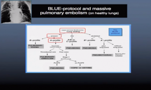 Slide 35 27:22 Below-So we see the A profile. So the next step is to ...