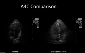 So Don’t All of the Above Confirm Pulmonary Embolus – The Right ...