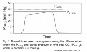The best way to conceptualize this is to imagine gas flowing from a ...