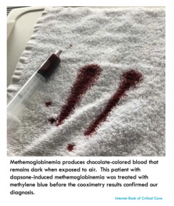 There are a variety of approaches, which may depend on local resources ...