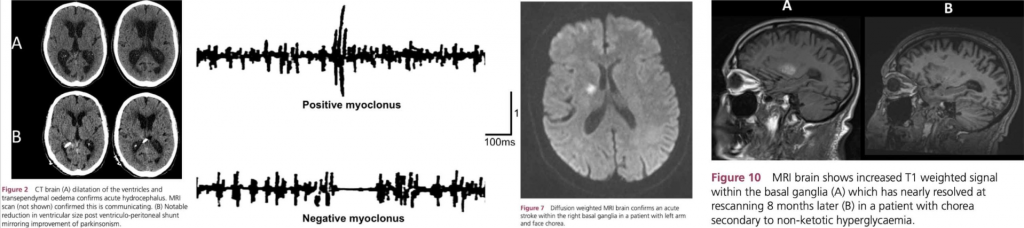 In this post, I review Dr. Josh Farkas ‘ Internet Book Of Critical Care ...
