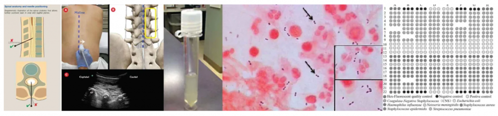 This chapter explores some general aspects of neurological infectious ...