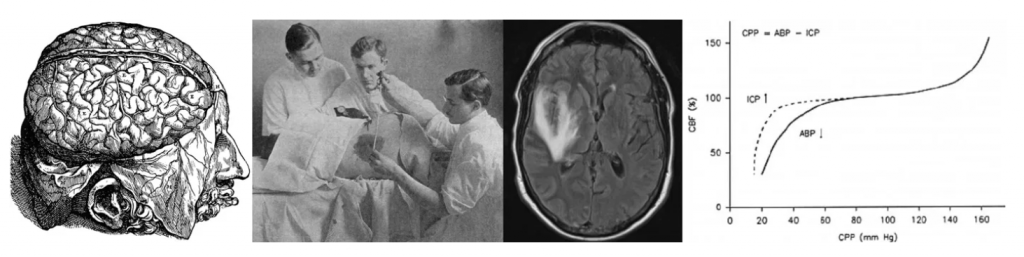 All that follows is from the above resource.