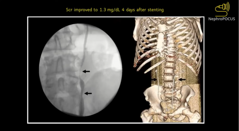 Fig13, 11:22–Below. A non-contrast CT in the ED was unrevealing. Dr ...