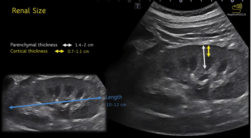 Now we come to the intrinsic causes of kidney injury.