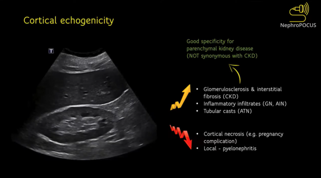 Now we come to the intrinsic causes of kidney injury.