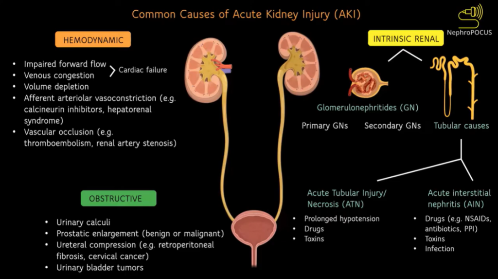 In this first section, Dr. Koratala discusses acute kidney injury due ...