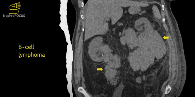 Fig9, 8:40. Below, the initial kidney ultrasound shows no evidence of ...