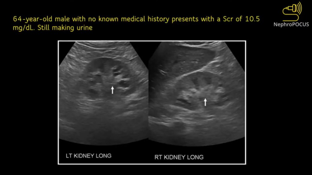 Fig9, 8:40. Below, the initial kidney ultrasound shows no evidence of ...