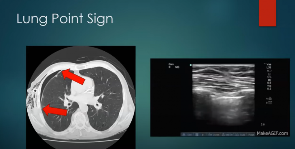 16:14 You are going to do a longitudinal scan, not a transverse scan ...