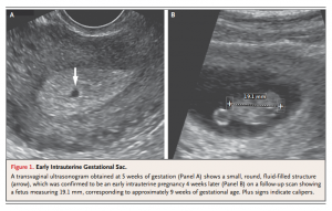 The yolk sac, a circular structure about 3 to 5 mm in diameter, makes ...