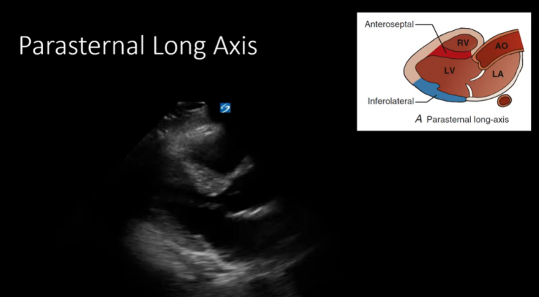 I’ve embedded some of the slides below. However, you should watch the ...