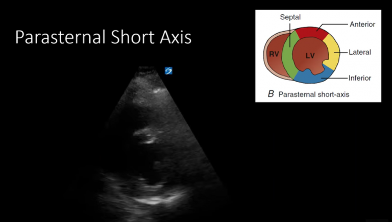 I’ve embedded some of the slides below. However, you should watch the ...