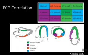 Remember, the great examples of the various wall motion abnormalities ...