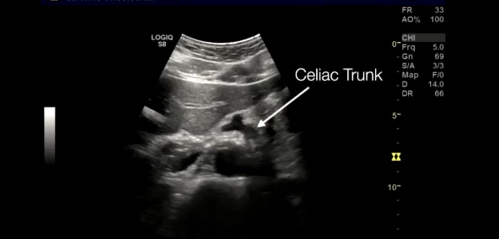 Another tranverse view