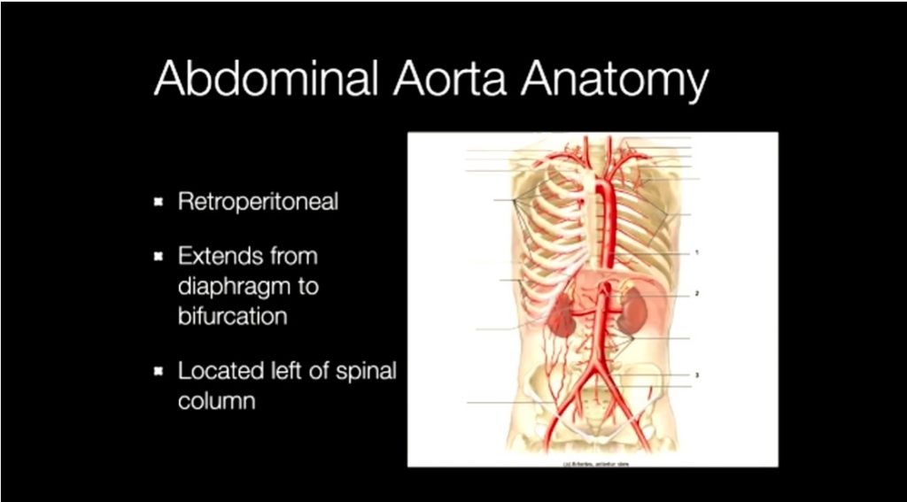 An Abdominal Aortic Aneurysm is greater than 3 cm.