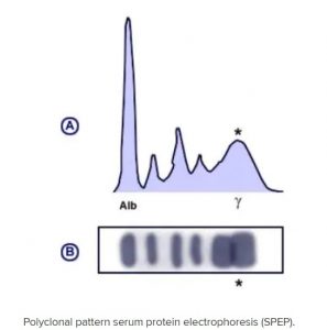 Polyclonal gammopathy