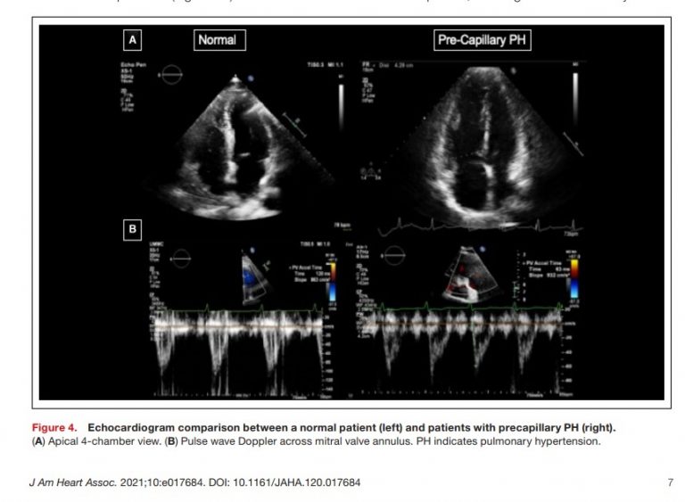 This entry was posted in Echocardiography , Pulmonary Hypertension ...