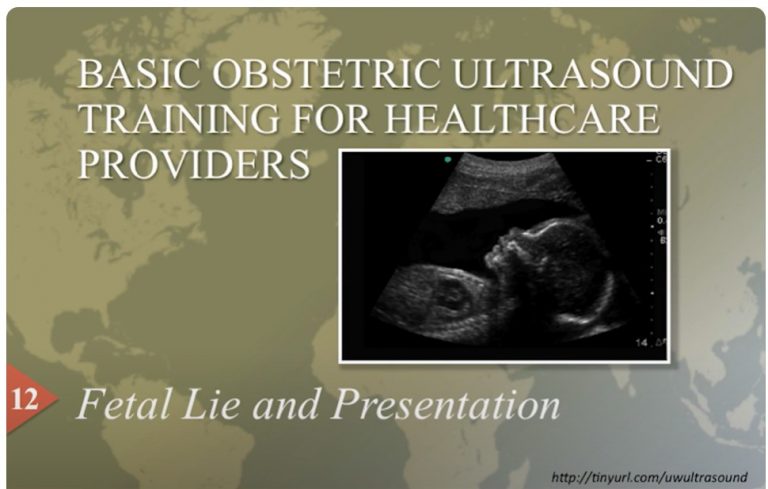UW Department of Obstetrics & Gynecology