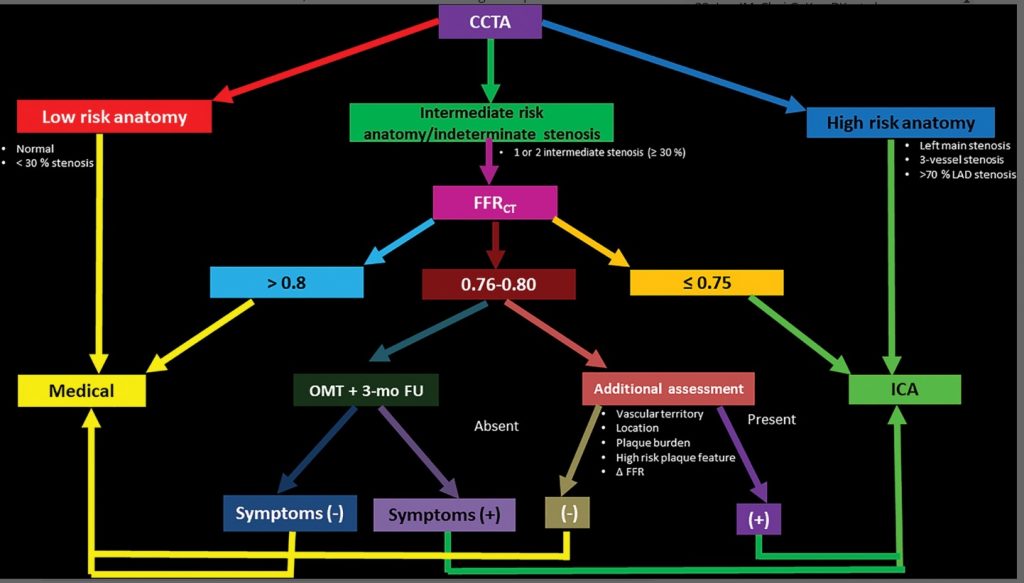 FFR CT in Multivessel Disease and Revascularization Planning