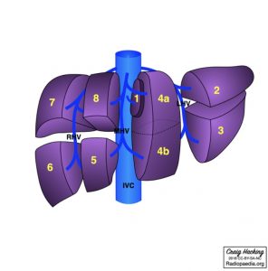 Today I review, link to, and embed “ Couinaud Classification of Liver ...
