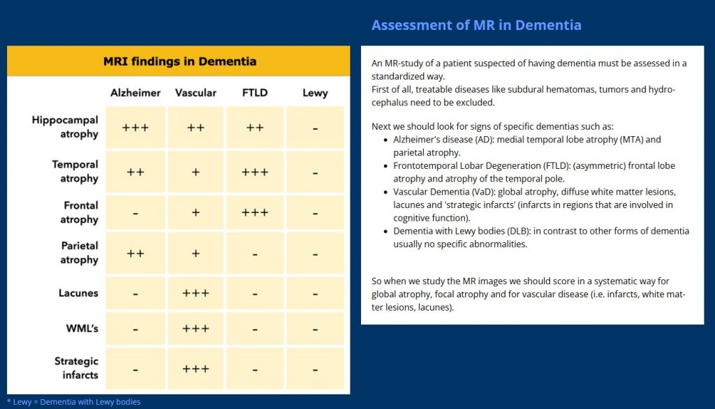 MRI Assessmebt in Dementia
