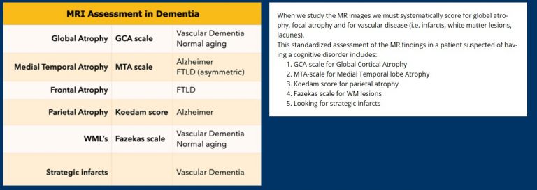 GCA-scale for Global Cortical Atrophy