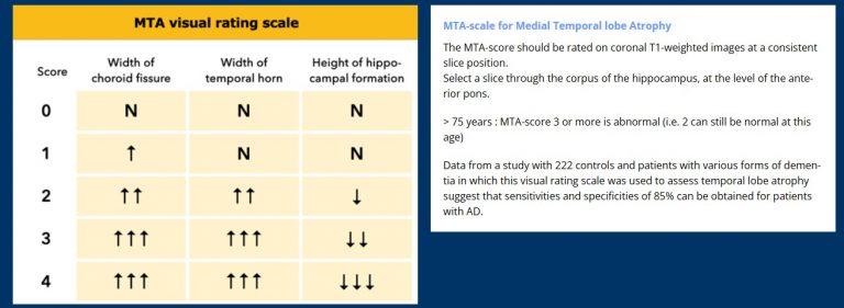 MTA-scale for Medial Temporal lobe Atrophy
