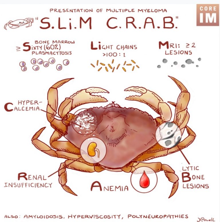 By definition, MGUS and SMM have no symptoms attributable to their ...