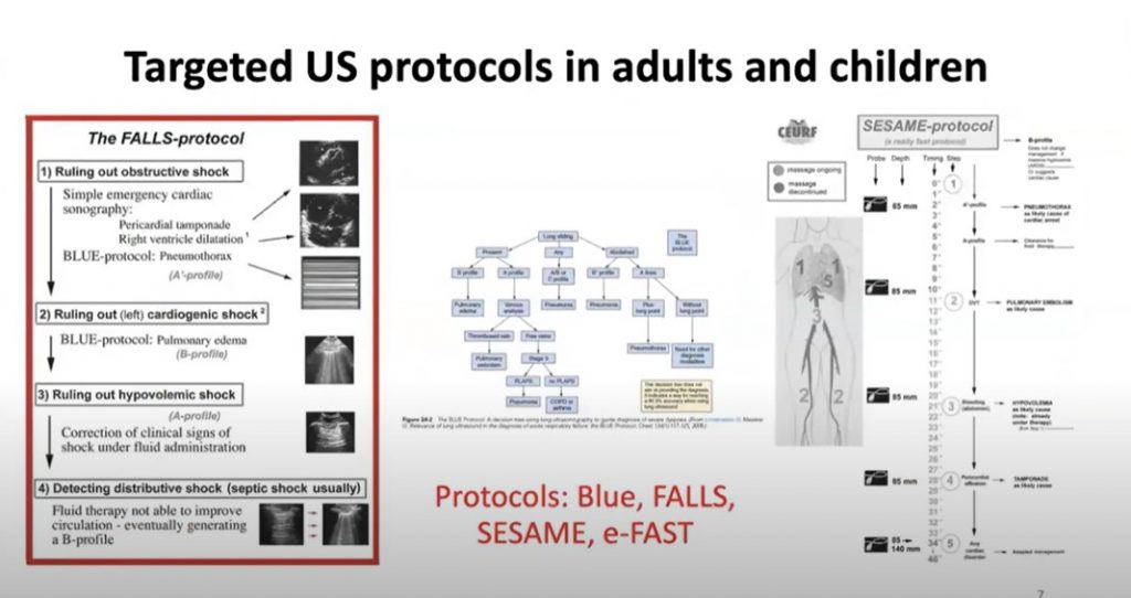 The SESAME Protocol for the POCUS assessment of the etiology of cardiac ...